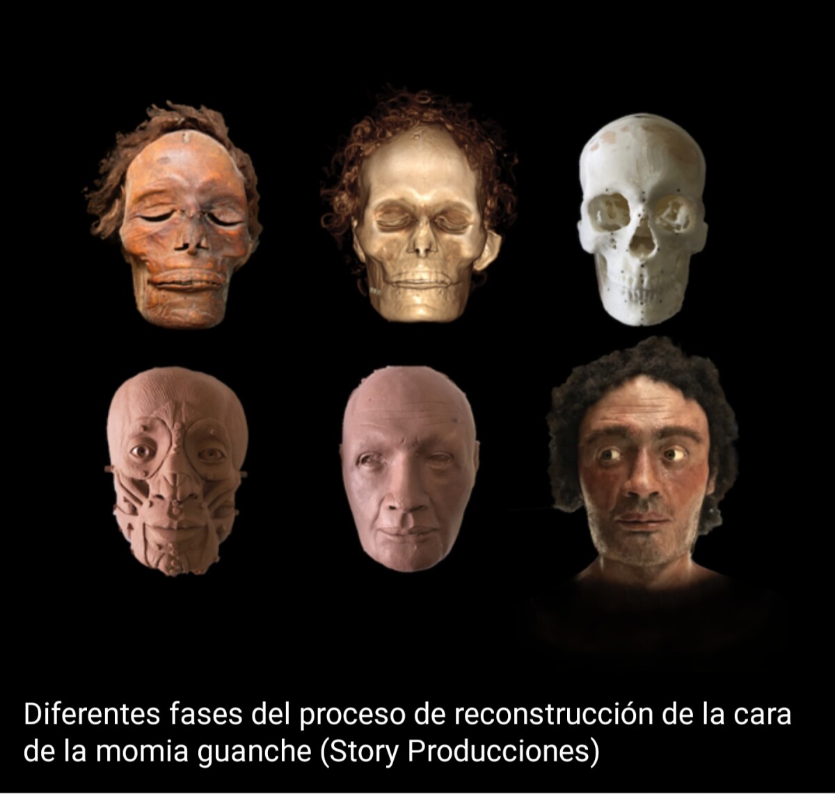 Mummified almost 1,000 years ago-Canary Islands