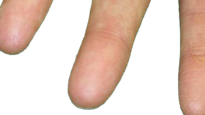 family with no fingerprints